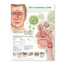 Understanding the Common Cold Anatomical Chart - 9780781786317 ...